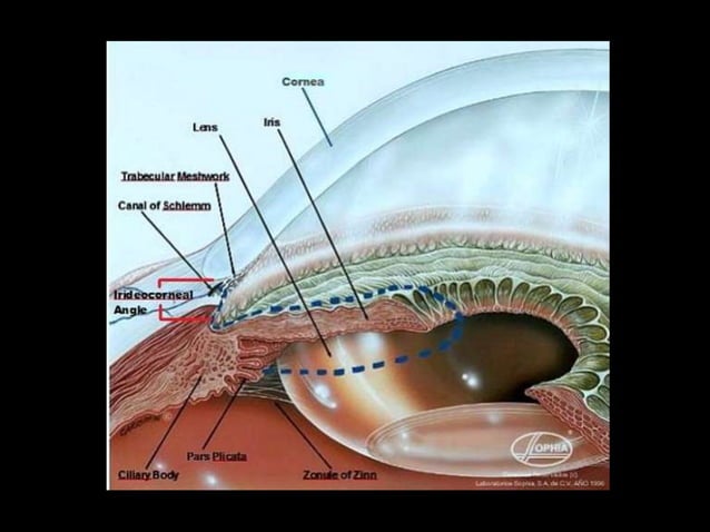 Pigment Dispersion Syndrome & Pigmentary Glaucoma