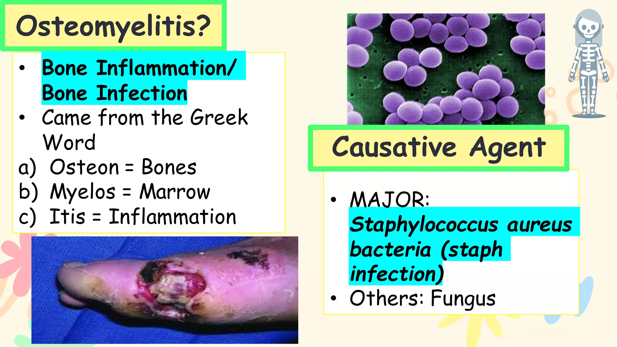 Osteomyelitis.pdf