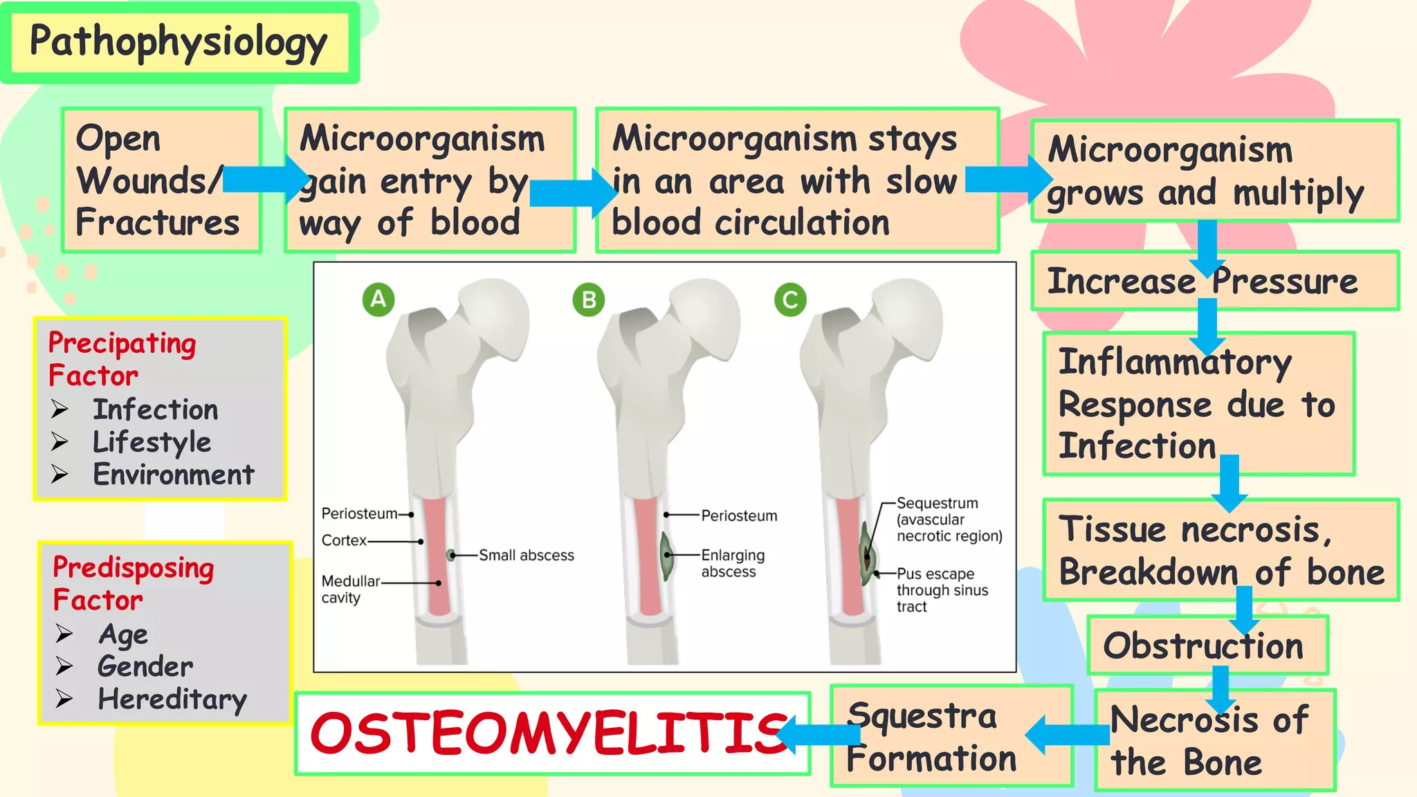 Osteomyelitis.pdf
