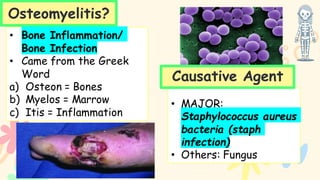 Osteomyelitis.pdf