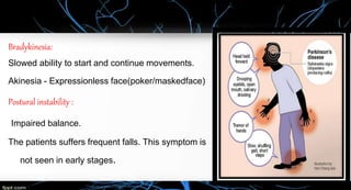Parkinson's Disease | PPTX
