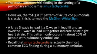 Pulmonary embolism | PPTX