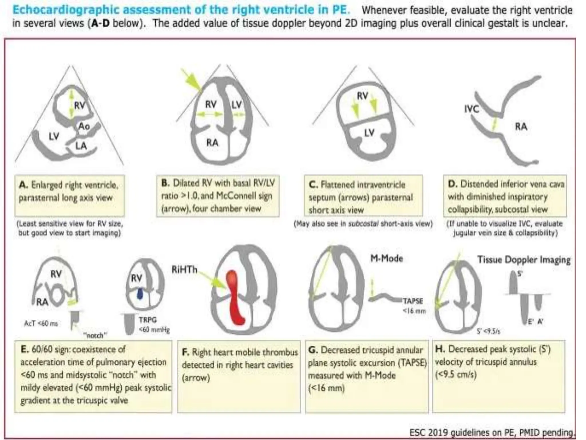 pe.pptx pulmonary embolism diagnosis and management | PPTX