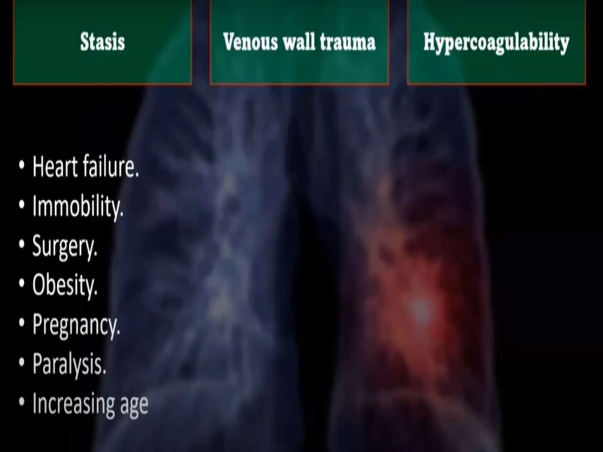 pe.pptx pulmonary embolism diagnosis and management | PPTX