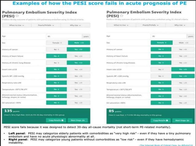 pe.pptx pulmonary embolism diagnosis and management | PPT