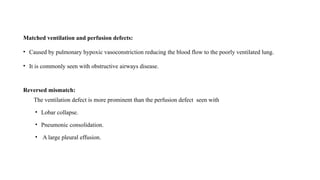 Pulmonary embolism ventilation perfusion scan | PPTX