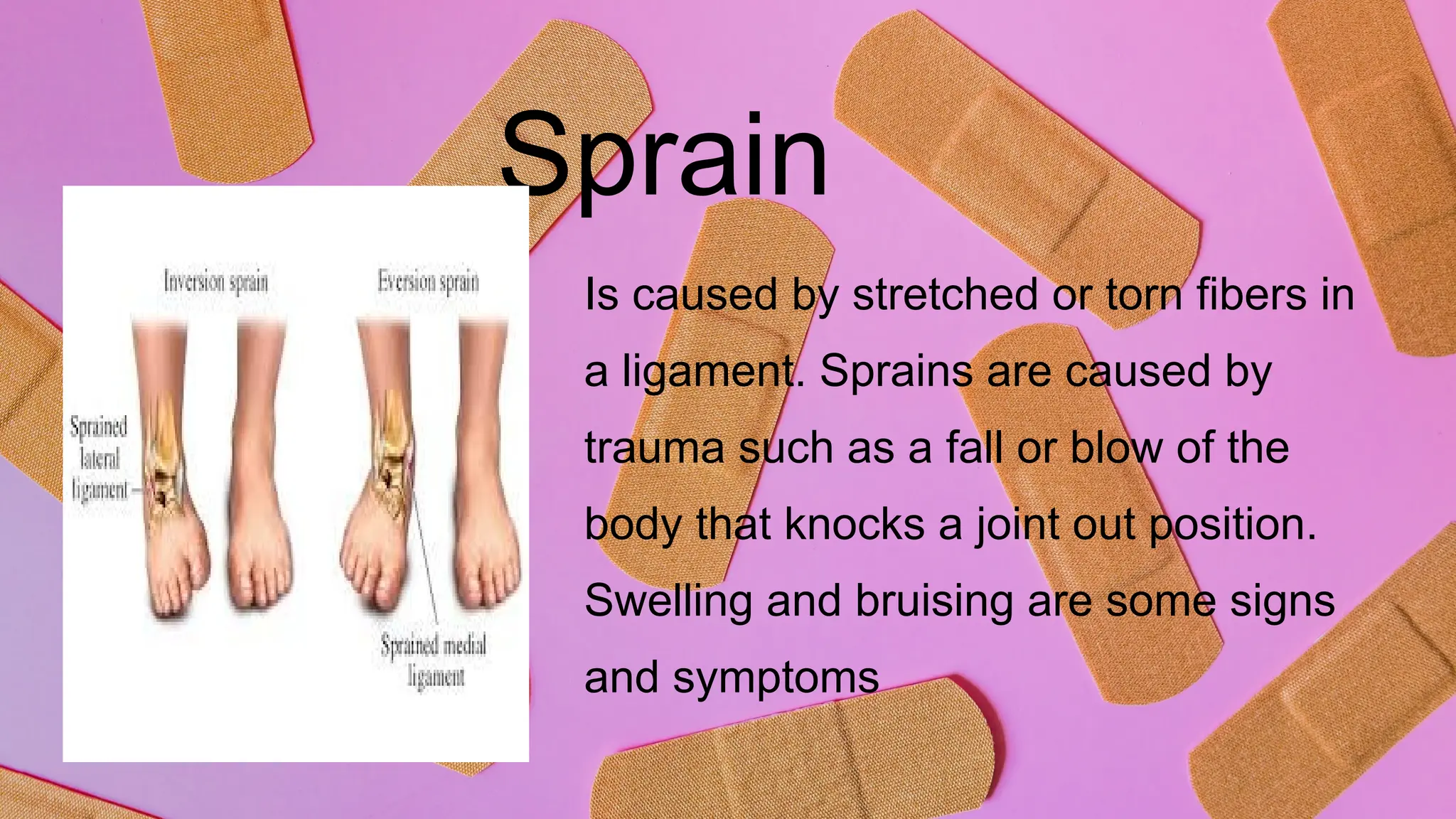 PE-FIRST-AID.powerpoint in physical education grade 9 | PPTX
