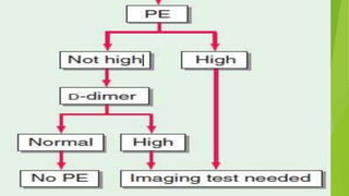 Diagnosis and managment of pulmonary embolism | PPT