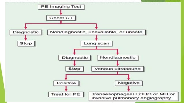 Diagnosis and managment of pulmonary embolism | PPT