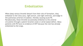 Diagnosis and managment of pulmonary embolism | PPT