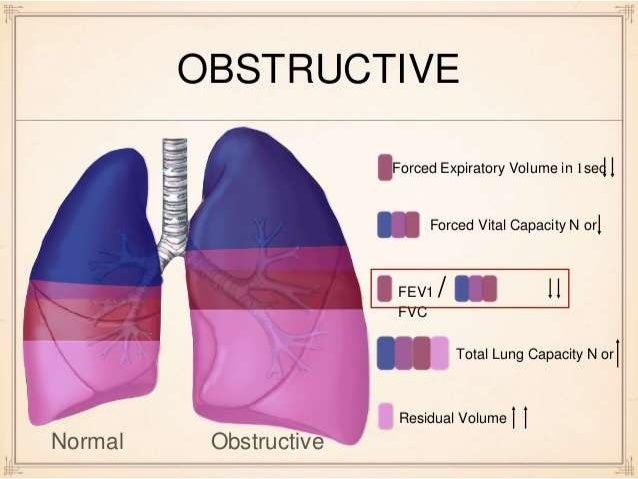 obstructive & restrictive lung disease