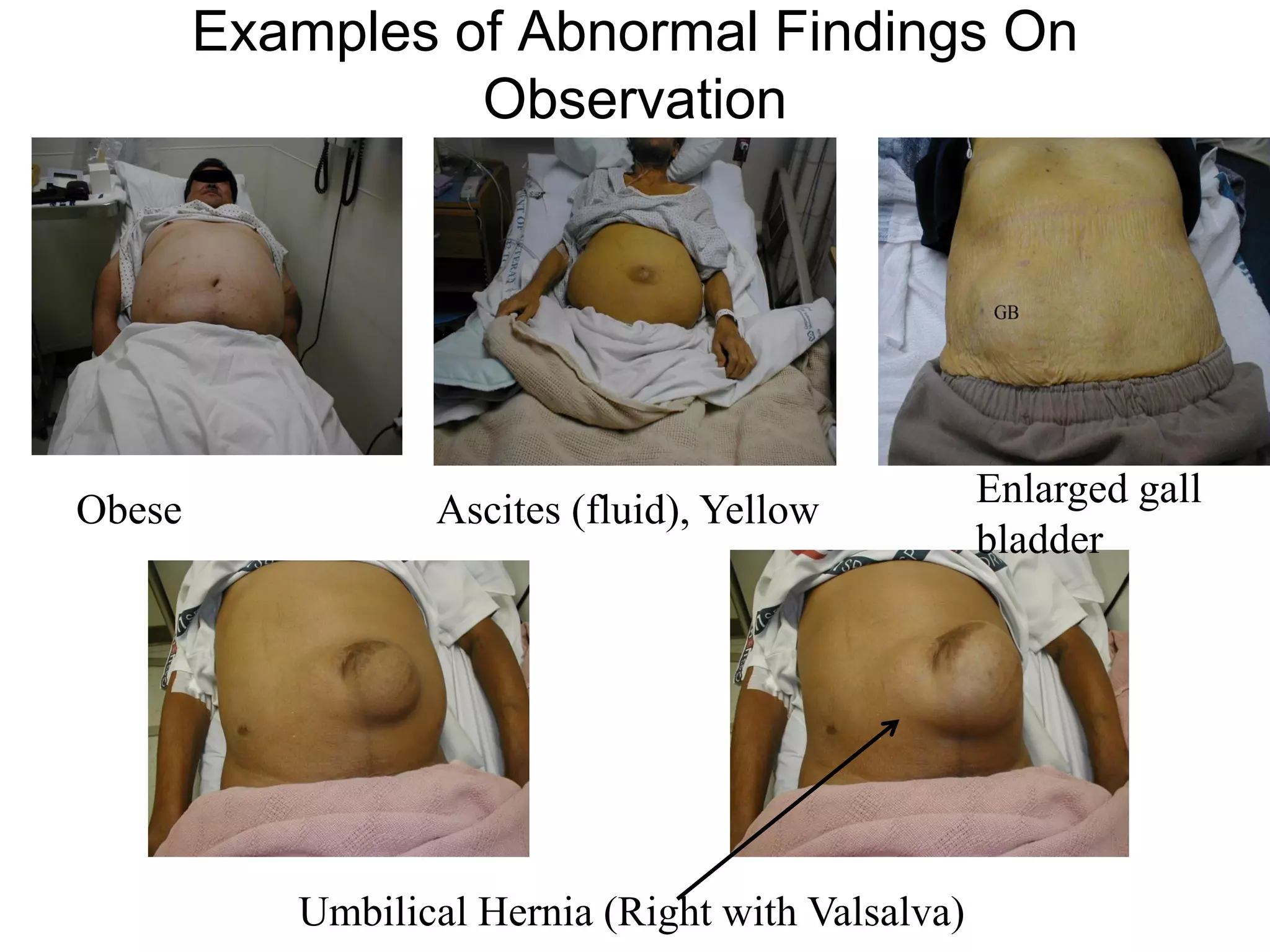 Pe abdominalexam | PDF