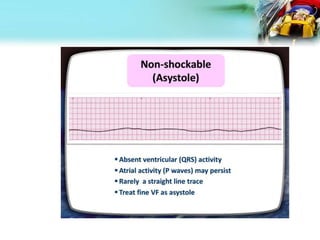 Pulseless Electrical Activity Vs Asystole