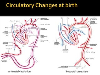 CONGENITAL HEART DISEASE | PPT