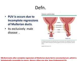 PEADIATRIC UROLOGY.pptx