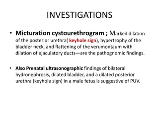 PEADIATRIC UROLOGY.pptx