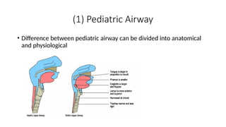 Peadiatric Airway Assessment Paediatric anaesthesia | PPTX
