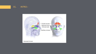 Sinusitis | PPT