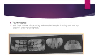 RADIOLOGY IN PEDIATRIC DENTISTRY | PPTX