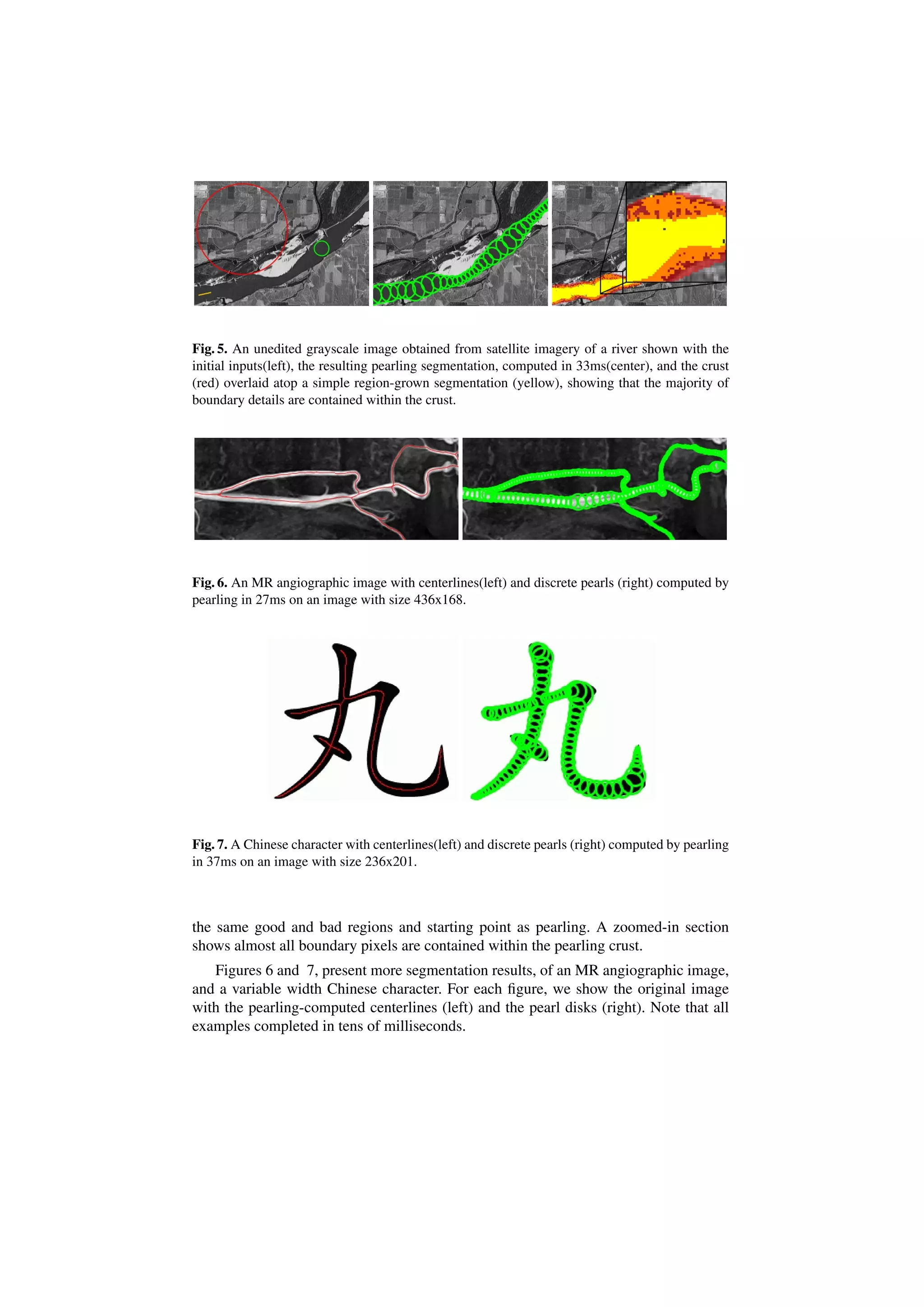 Pearling stroke segmentation with crusted pearl strings | PDF | 3-D Graphics | Computer Software ...