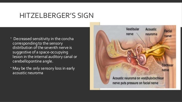 Pearls for assessing sensation of the face and head