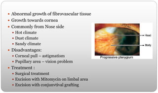 Pearls of ophthalmology | PDF