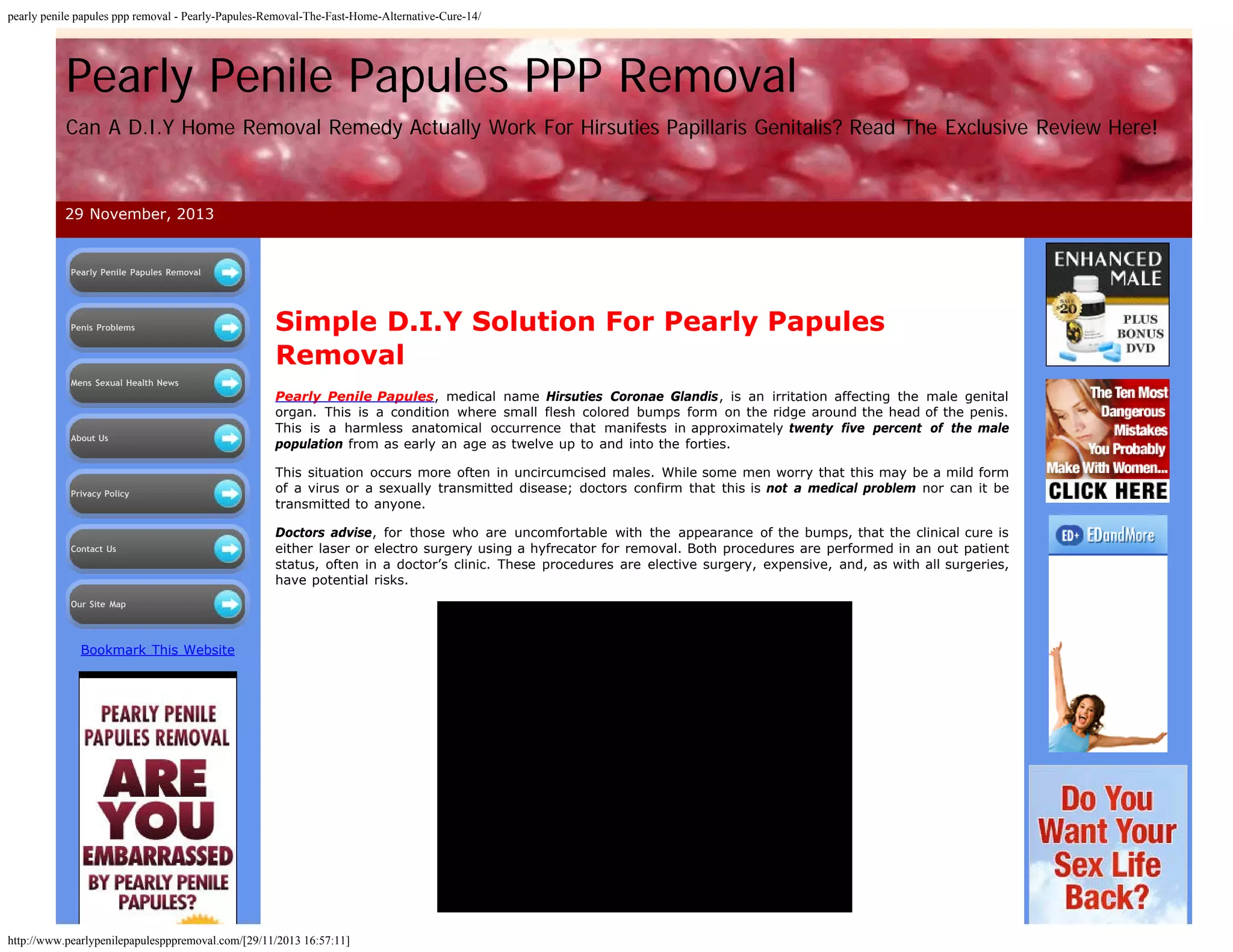 pearly papules removal the fast home alternative cure | PDF | Sexual ...
