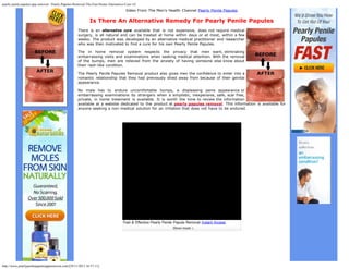 Pearly Penile Papules Removal