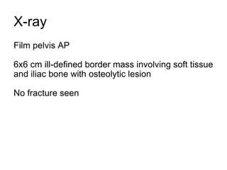 Pearr osteosarcoma | PPT