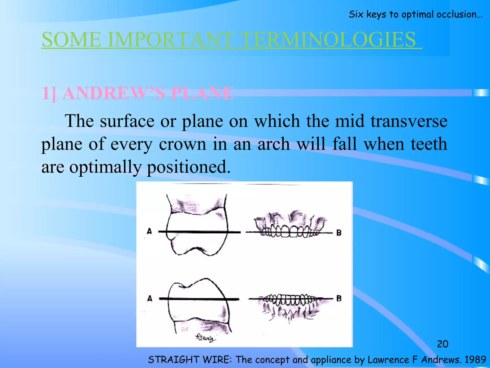 preadjusted edgewise appliance | PPT