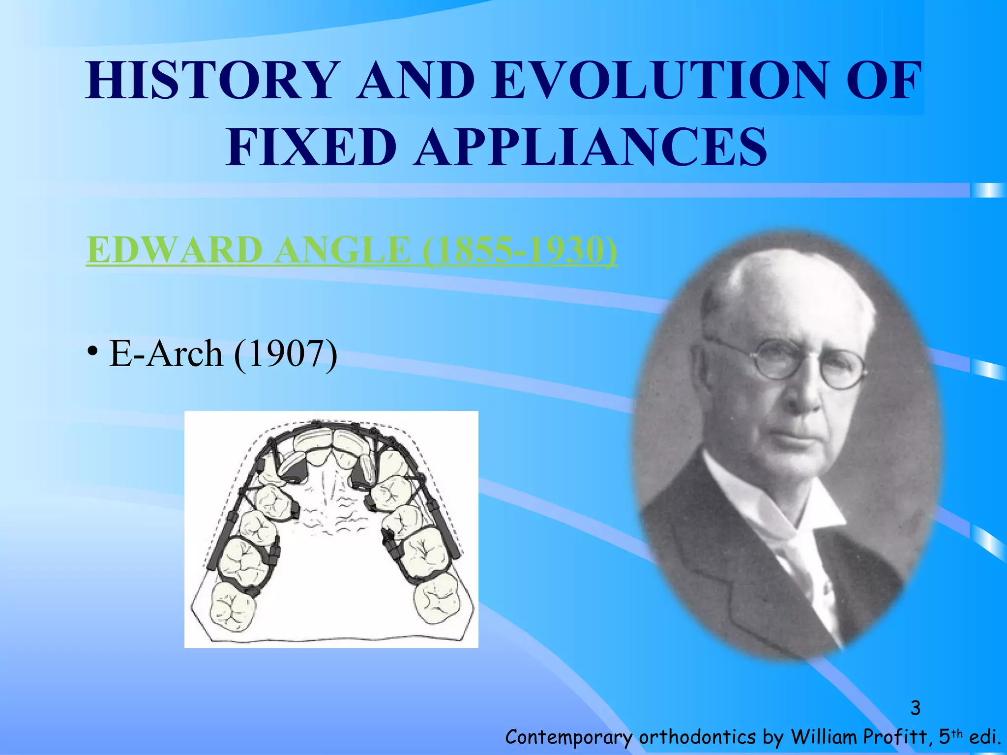 preadjusted edgewise appliance | PPT
