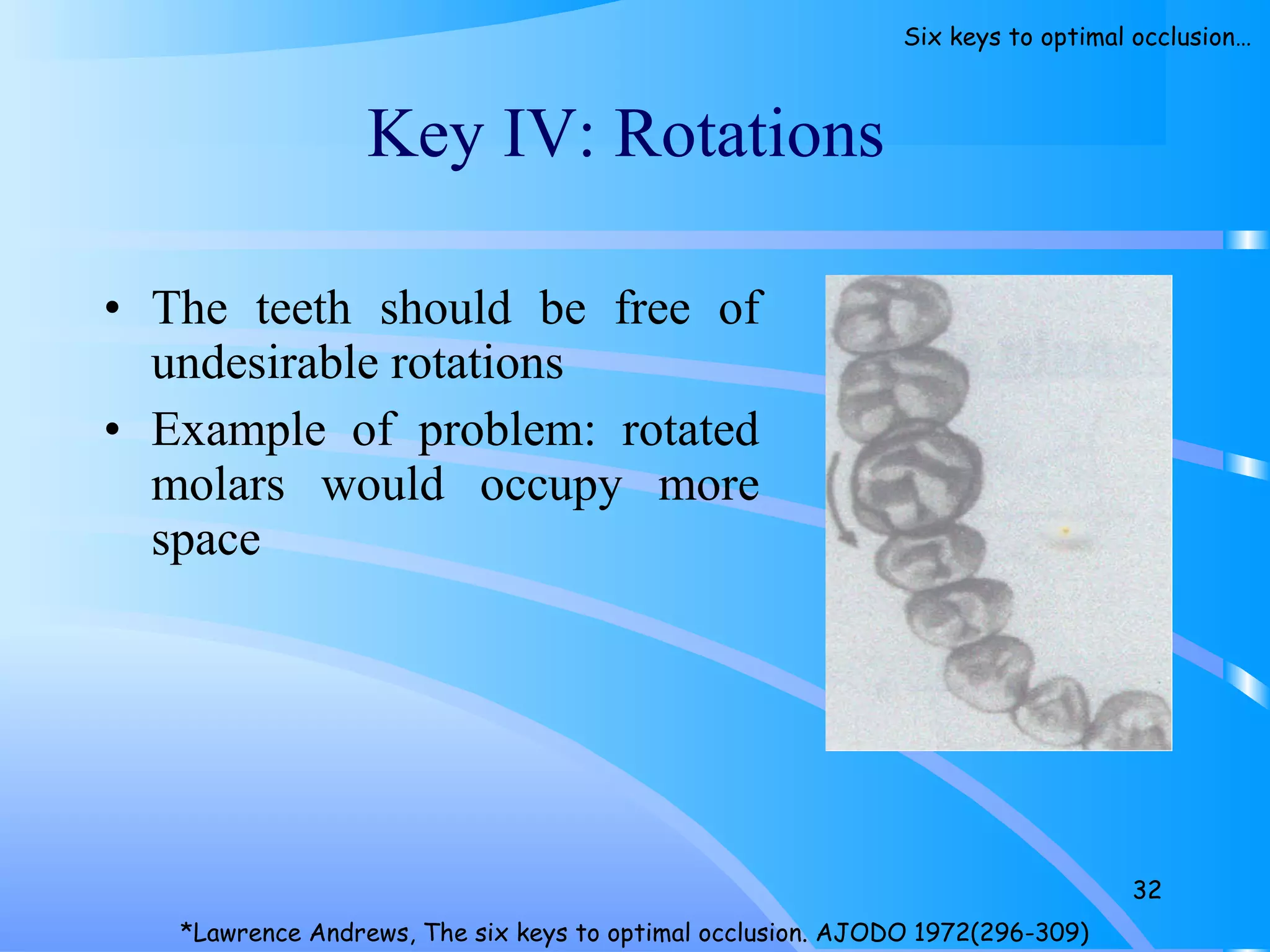 preadjusted edgewise appliance | PPT