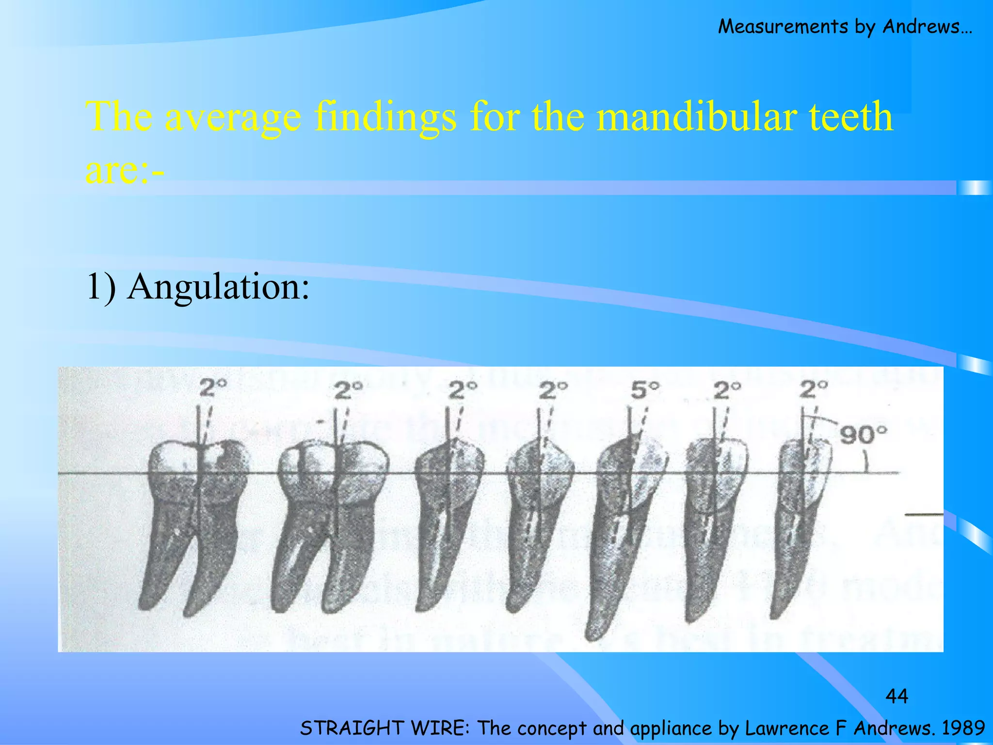 preadjusted edgewise appliance | PPT