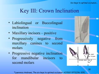 preadjusted edgewise appliance | PPT