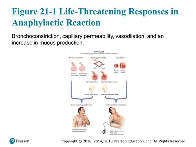 Pec11 chap 21 anaphylactic reactions | PPT