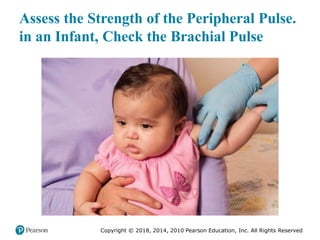 Brachial Pulse Infant