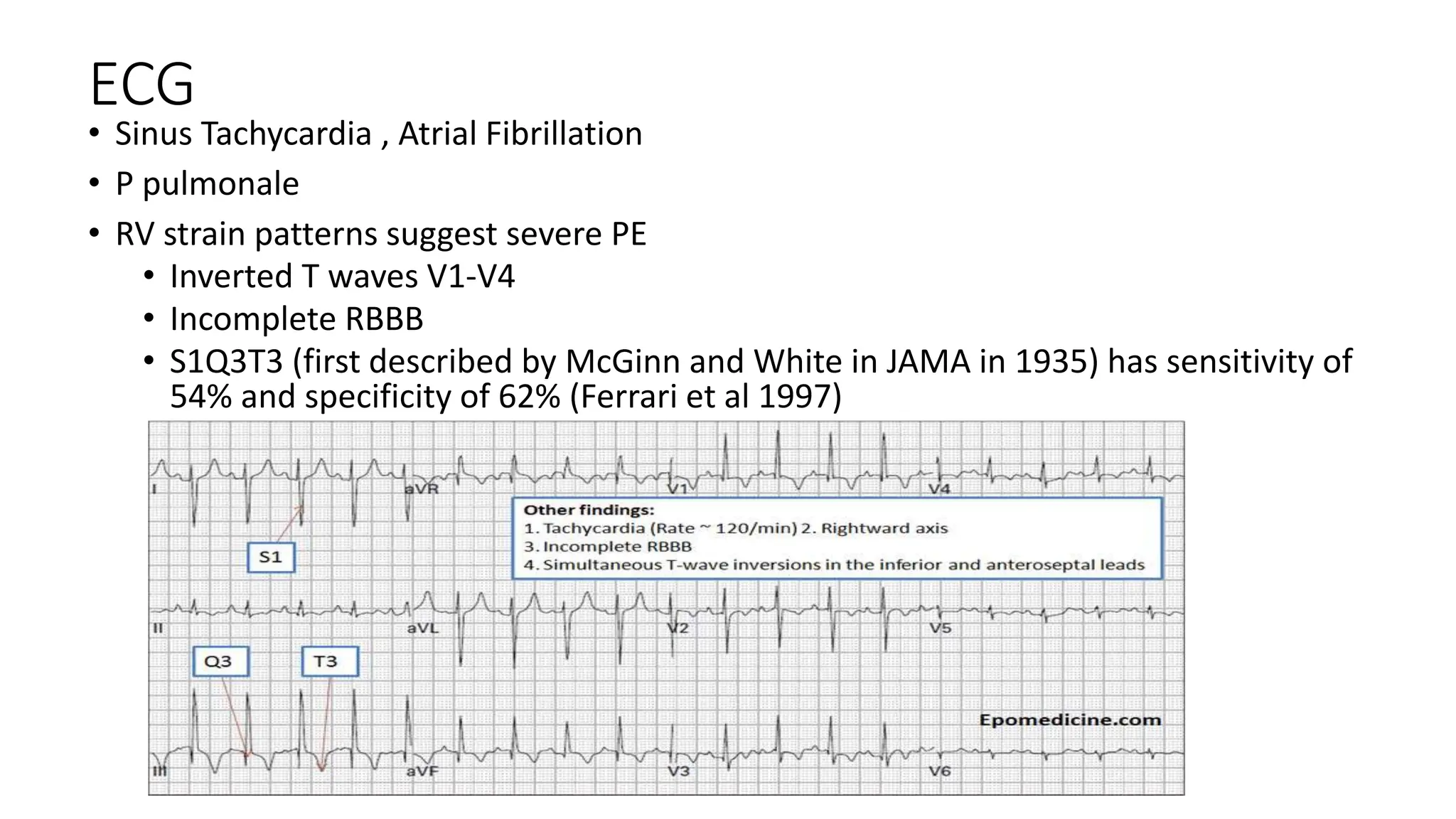 Pulmonary Embolism for Nurses.pptx