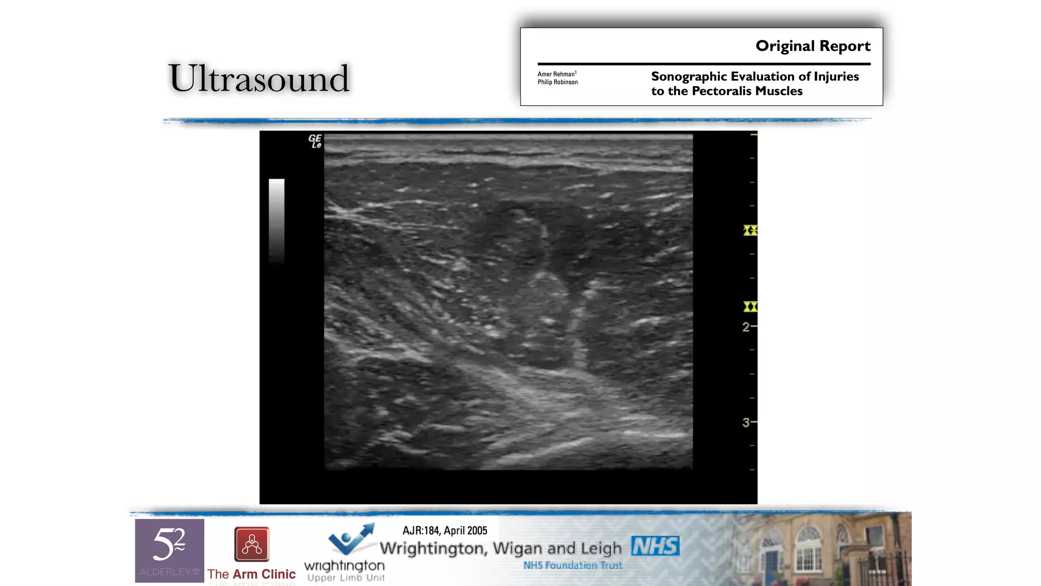 Pectoralis Major Injuries for BESS 2020 | PDF