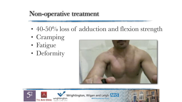 Pectoralis Major Injuries for BESS 2020 | PDF | Physical Therapy | Wellness