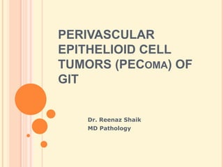 Perivascular Epithelioid Cell Tumors ( PEComa) of GIT | PPT