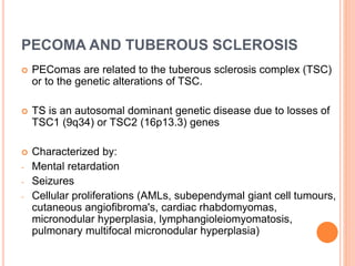 Perivascular Epithelioid Cell Tumors ( PEComa) of GIT | PPT