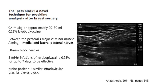 Pecs block, serratus plane block with literature review when and how | PPTX