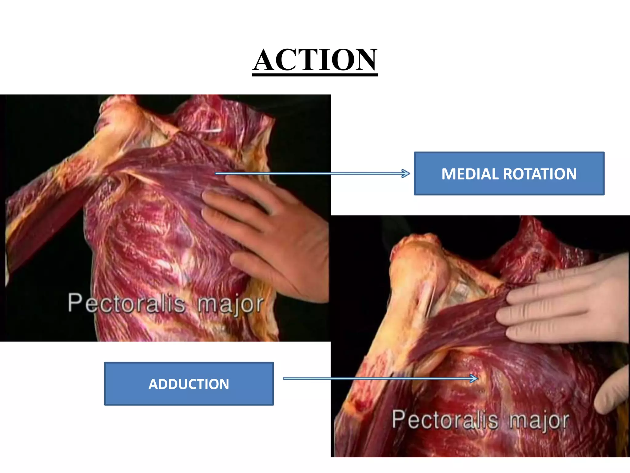 Pectoralis Major Myocutaneous Flap in Head and Neck Reconstruction | PPTX
