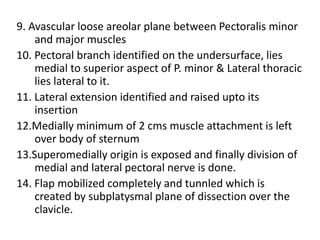 Pectoralis Major Myocutaneous Flap in Head and Neck Reconstruction | PPTX