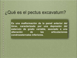 Pectus excavatum | PPTX