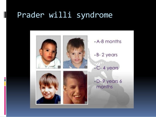 Peculiarities of children in differnet age group