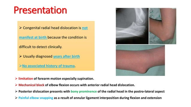 Pediatric Radial head dislocation | PPTX