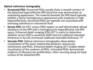 Pigment epithelial detachment (PED) | PPTX