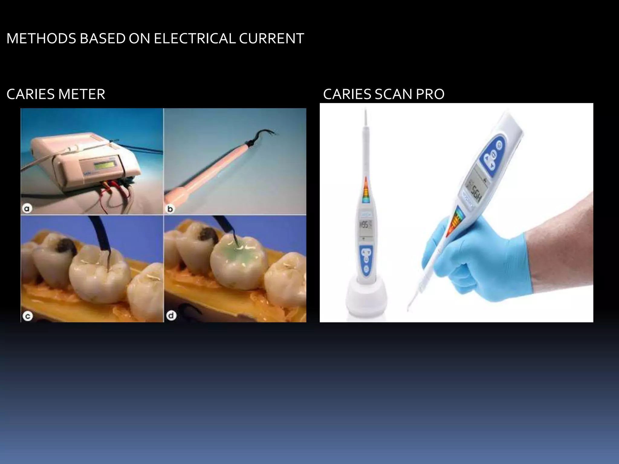 Diagnosis of dental caries | PPTX