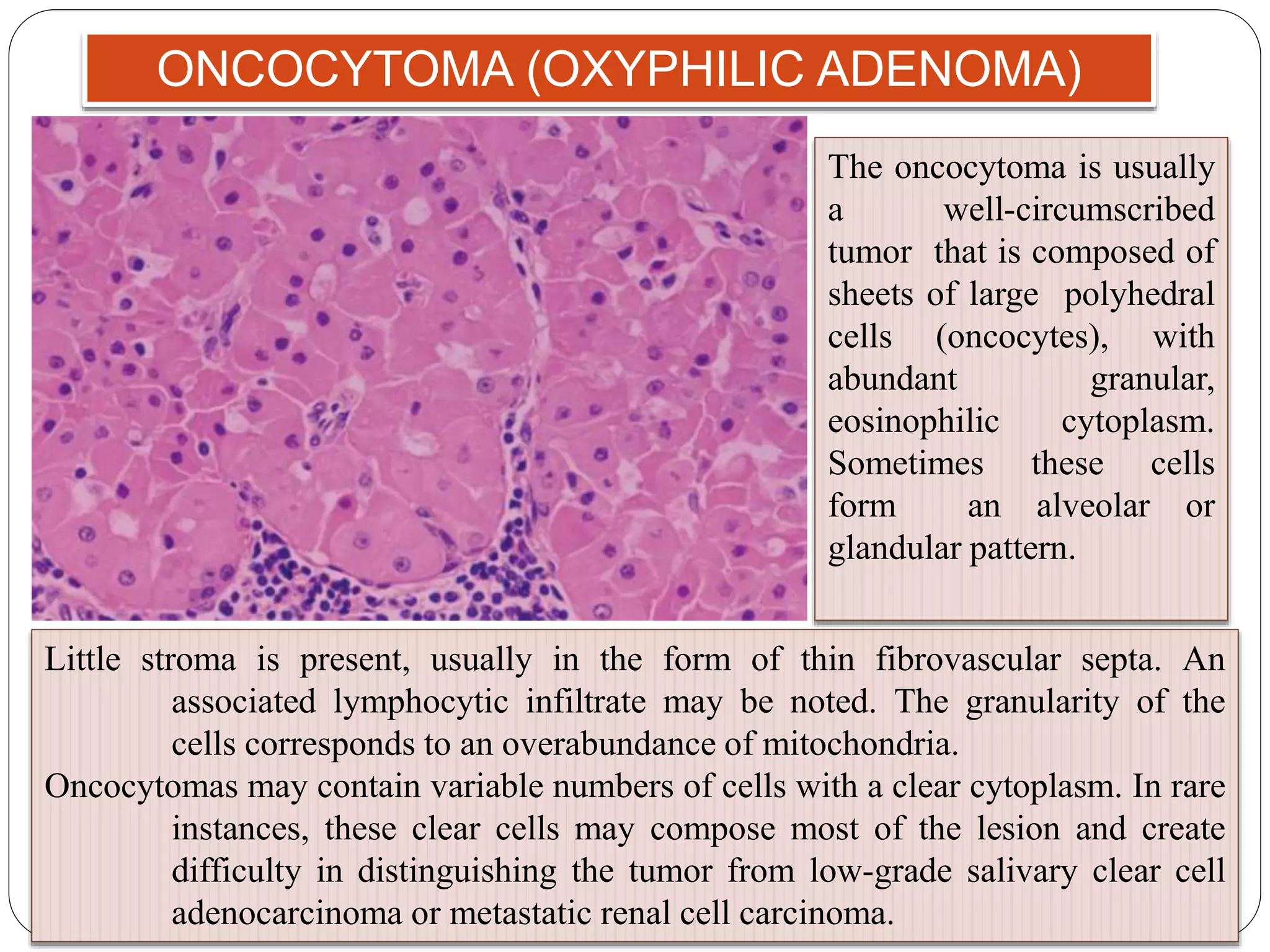 Oncocyte in salivary gland.pptx